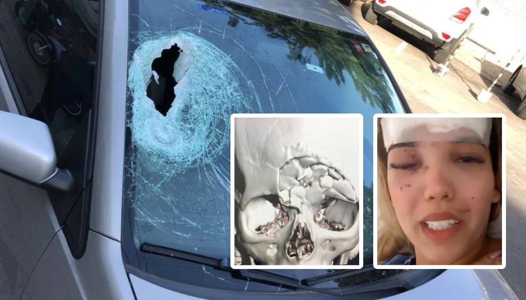 Advogada atingida por pedra no ES: 'Não sinto raiva e sou grata por ...