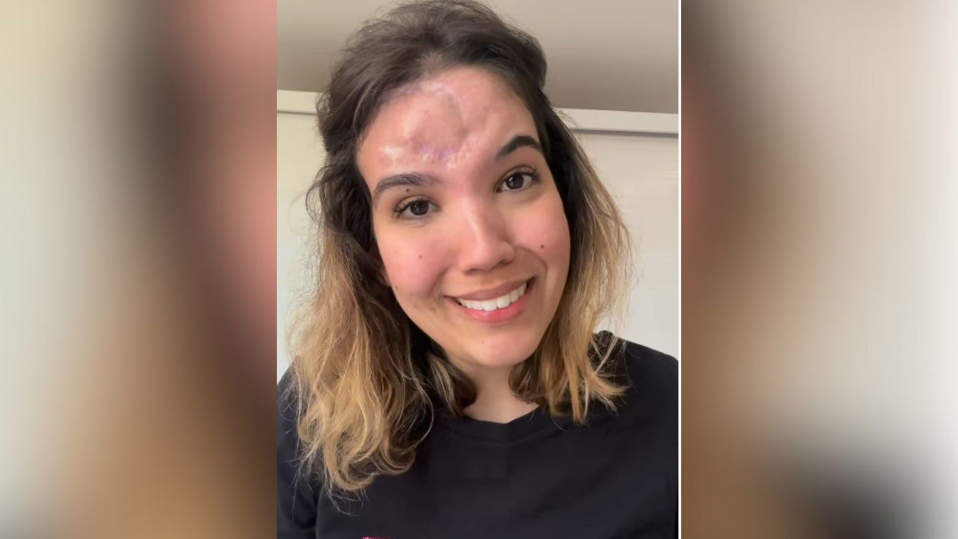 Advogada que levou pedrada na Rodovia do Sol vai fazer tratamento nos ...